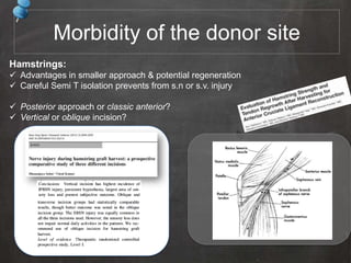 ACL Graft Selection in 2013 | PPT