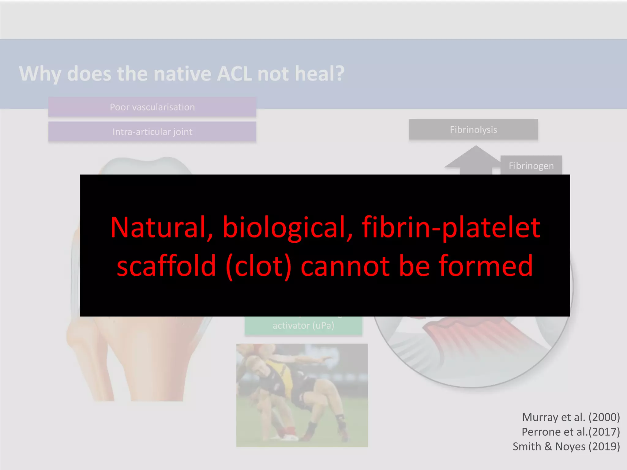 ACL healing presentation.pptx