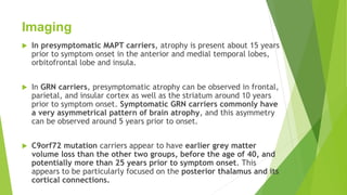 Frontotemporal dementia - current concepts | PPTX