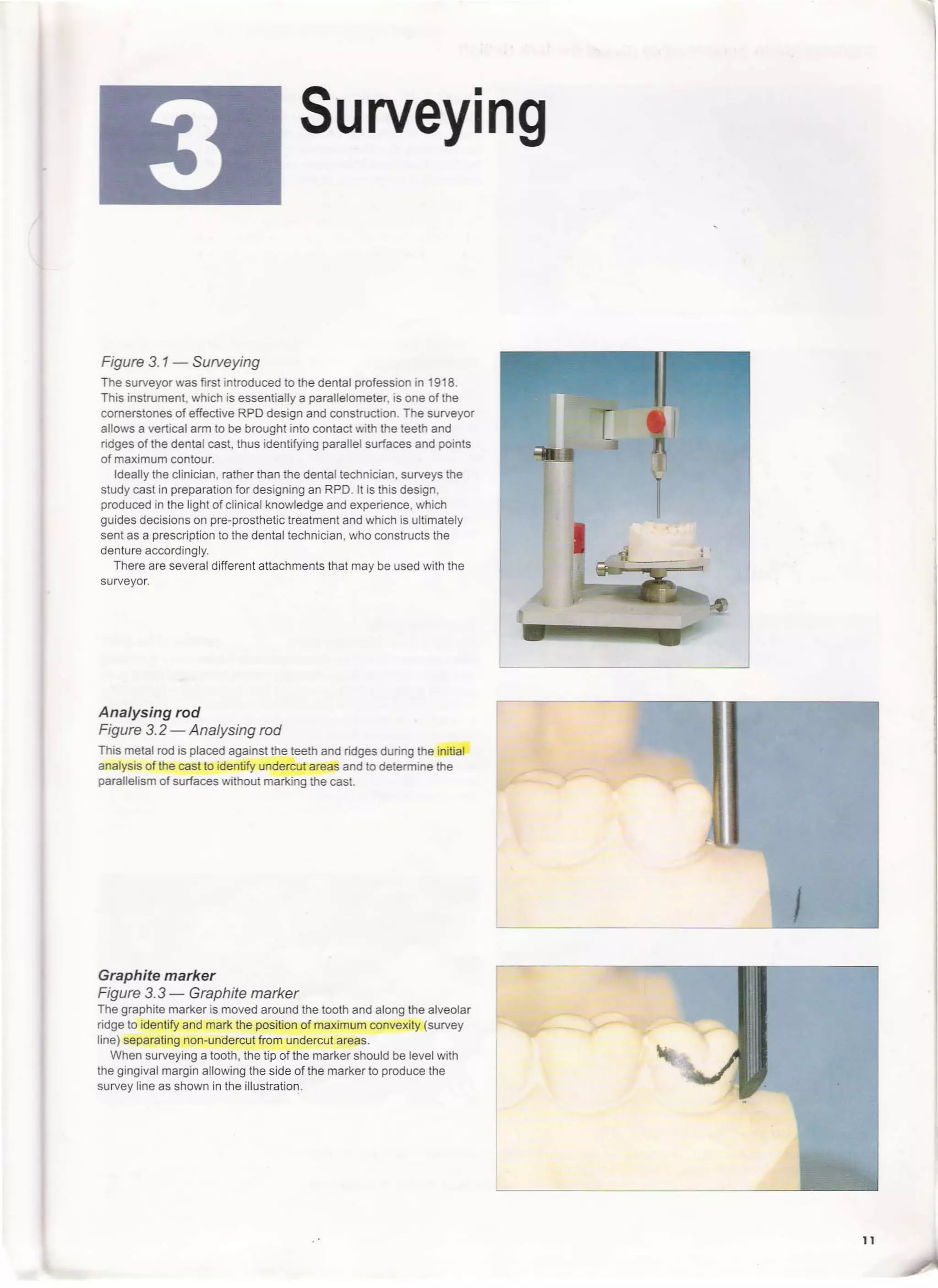 A clinical guide_to_removable_partial_denture_design | PDF