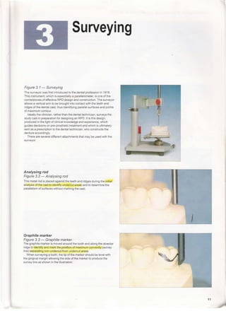 A clinical guide_to_removable_partial_denture_design | PDF