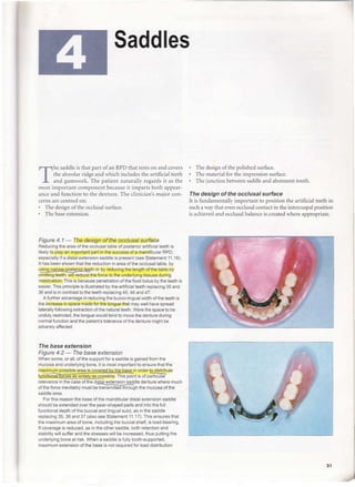 A clinical guide_to_removable_partial_denture_design | PDF