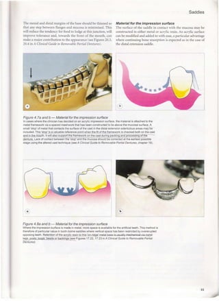 A clinical guide_to_removable_partial_denture_design | PDF