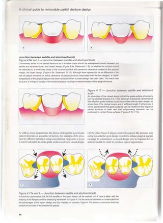 A clinical guide_to_removable_partial_denture_design | PDF