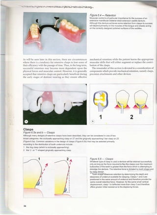 A clinical guide_to_removable_partial_denture_design | PDF