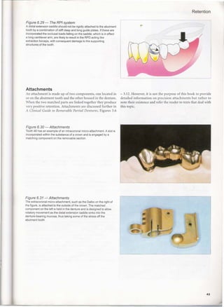 A clinical guide_to_removable_partial_denture_design | PDF