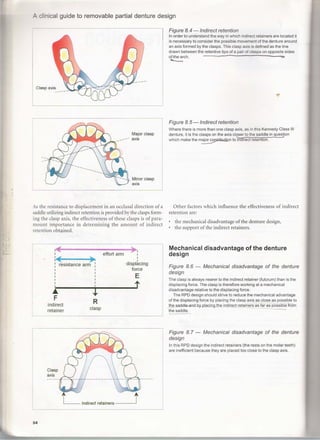 A clinical guide_to_removable_partial_denture_design | PDF