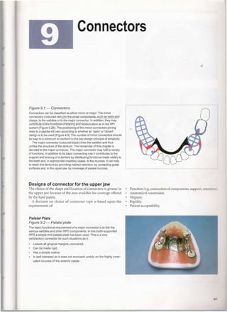 A clinical guide_to_removable_partial_denture_design | PDF