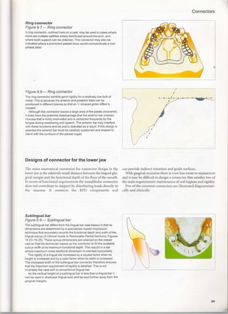 A clinical guide_to_removable_partial_denture_design | PDF