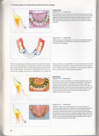 A clinical guide_to_removable_partial_denture_design | PDF