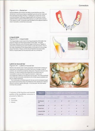 A clinical guide_to_removable_partial_denture_design | PDF