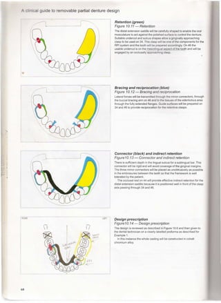 A clinical guide_to_removable_partial_denture_design | PDF
