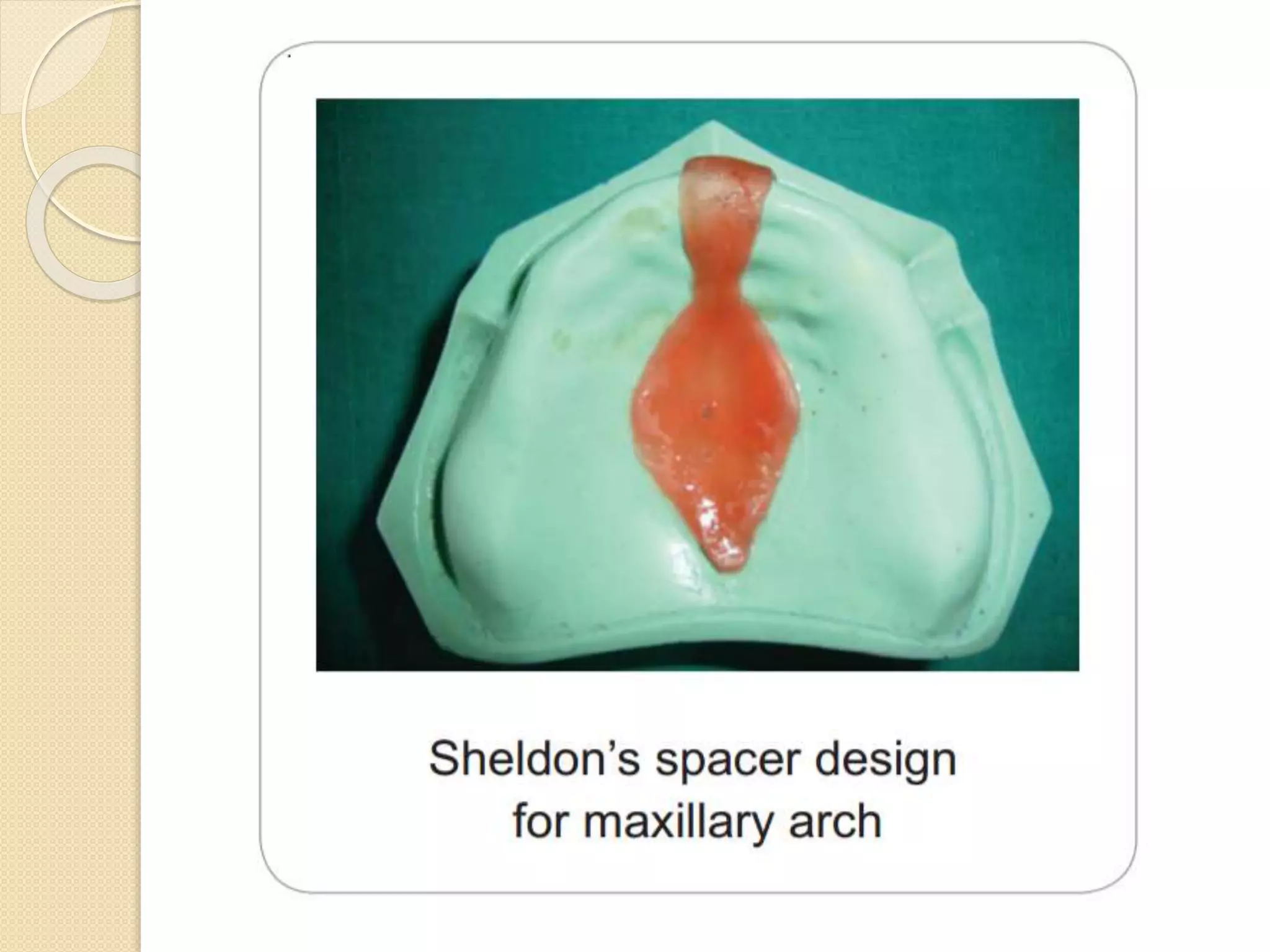 A Clinical Review of Spacer Design for Conventional_124155.pptx ...