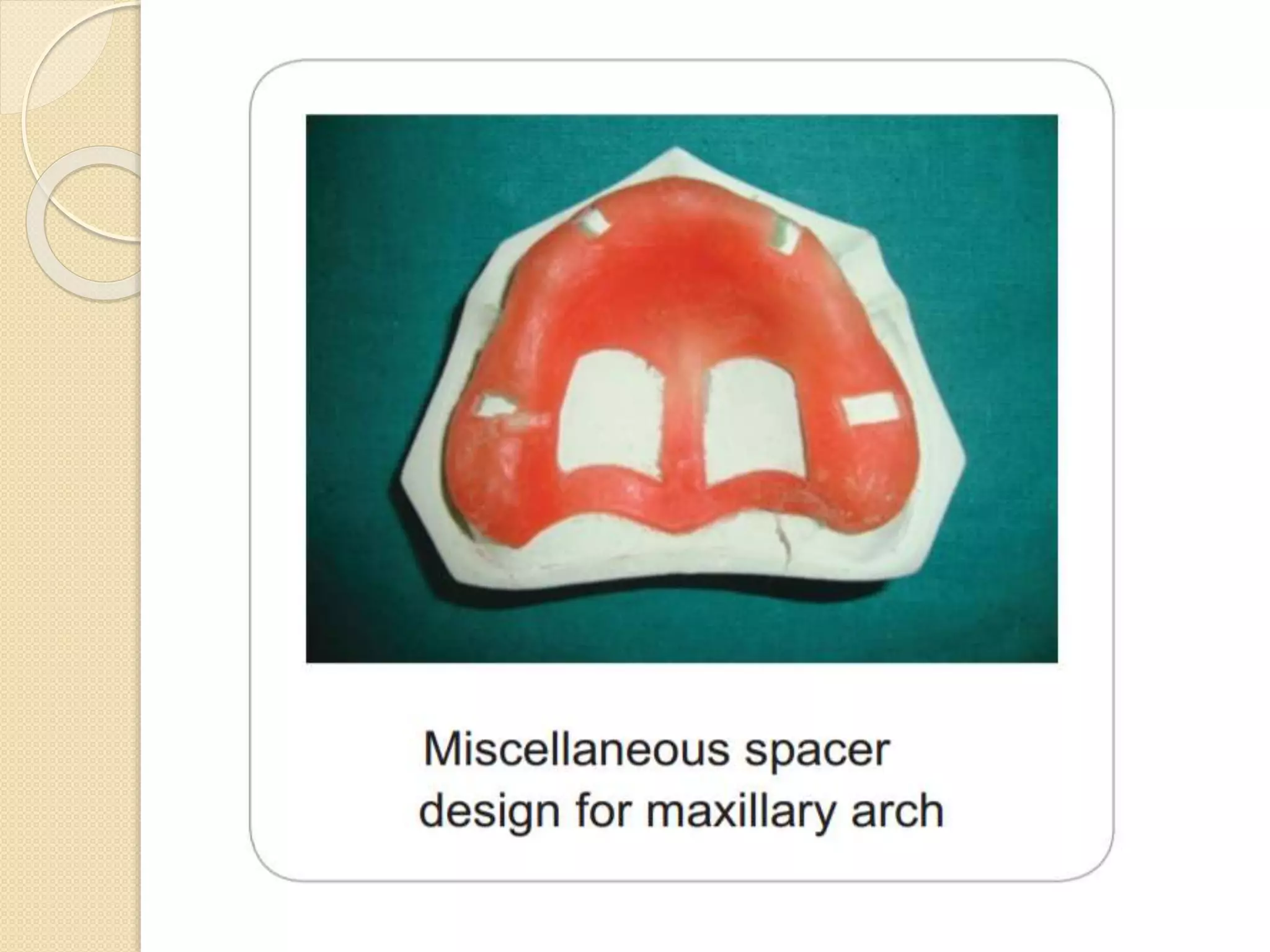 A Clinical Review of Spacer Design for Conventional_124155.pptx ...