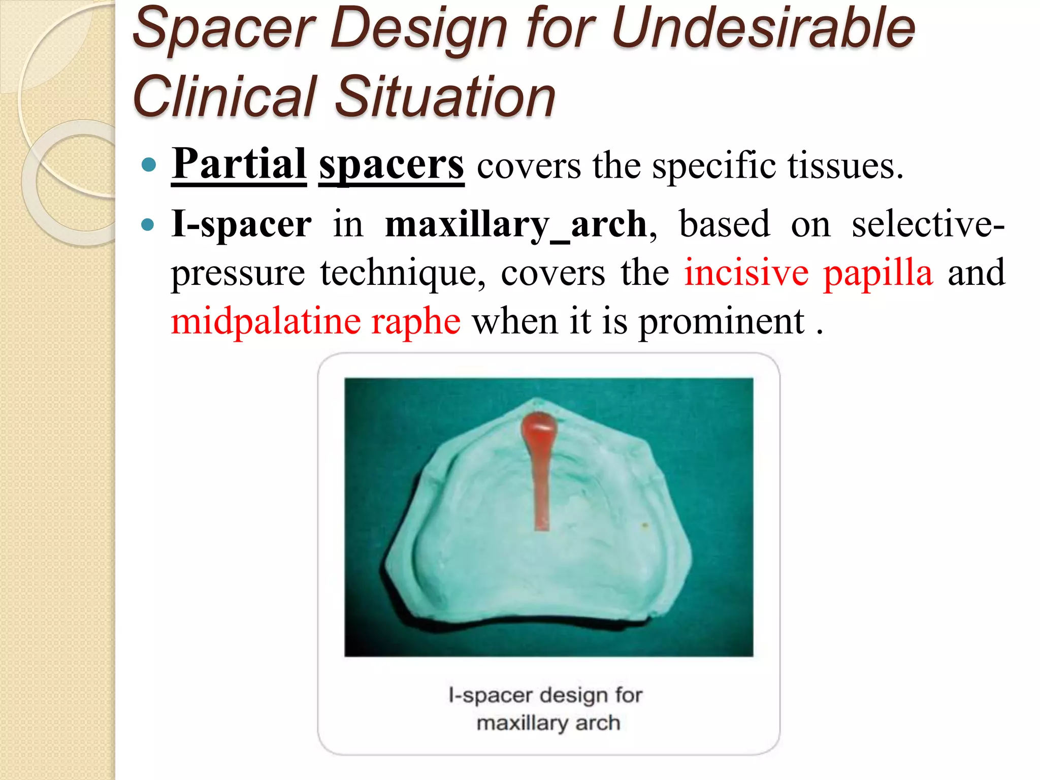 A Clinical Review of Spacer Design for Conventional_124155.pptx