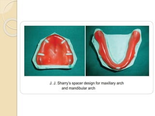 A Clinical Review of Spacer Design for Conventional_124155.pptx