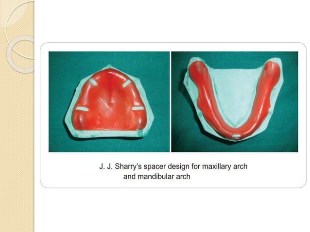 A Clinical Review of Spacer Design for Conventional_124155.pptx ...