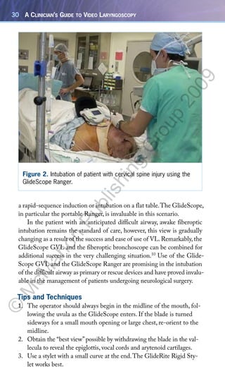 A clinicians guide_to_video_laryngoscopy | PDF