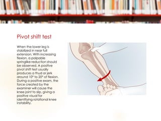 Acl injury | PPT