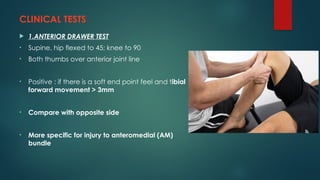 Anterior cruciate ligaments injury ortho | PPTX