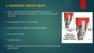 Anterior cruciate ligaments injury ortho | PPTX