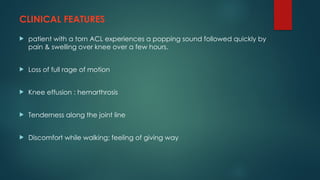 Anterior cruciate ligaments injury ortho | PPTX