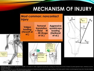 ACL Injury diagnosis and management.pptx