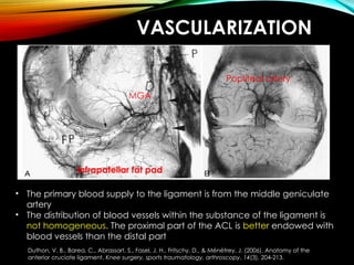 ACL Injury diagnosis and management.pptx