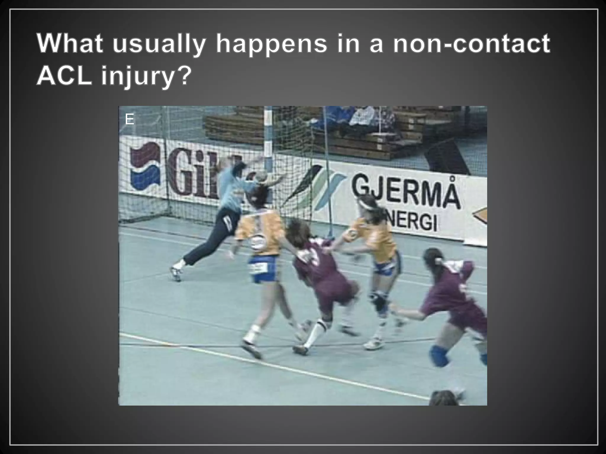 ACL injury screening and prevention CATS meeting 2016 | PPTX