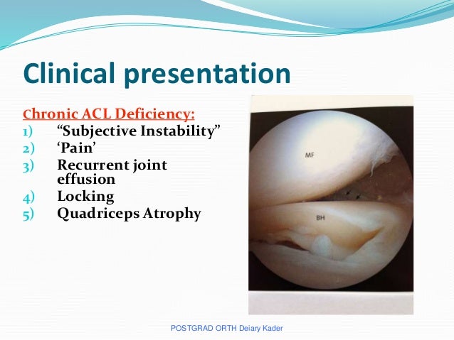 Updated ACL and MCL Injuries for Postgraduate Orthopaedic Course in N…