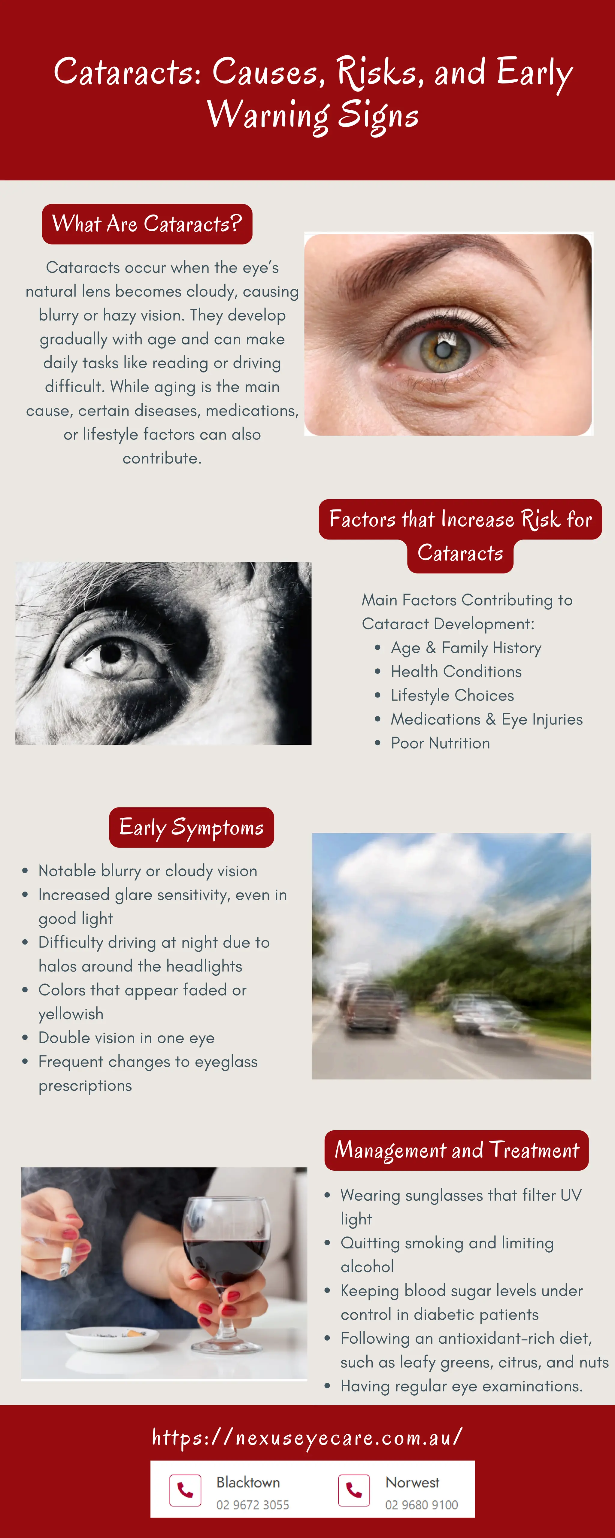 A Closer Look at Cataracts Causes, Risks, and Early Warning Signs | PDF