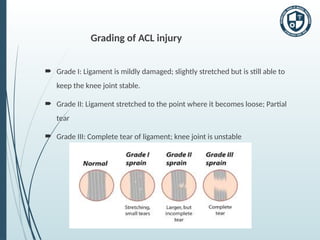 ACL & PCL Reconstruction Procedure..pptx