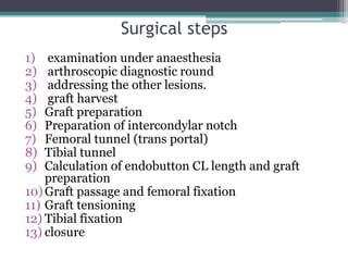 ACL reconstruction quadrapled hamstring graft | PPTX