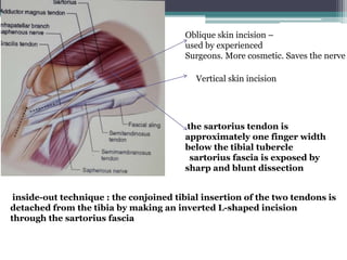 ACL reconstruction quadrapled hamstring graft | PPTX
