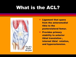 Acl prevention women | PPT