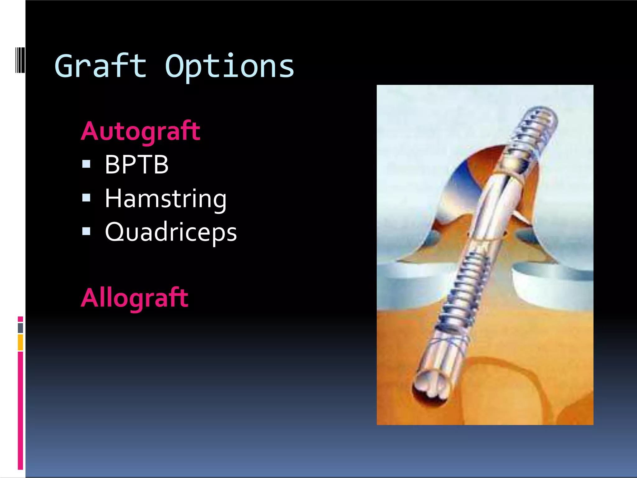 ACL Recon.pptx