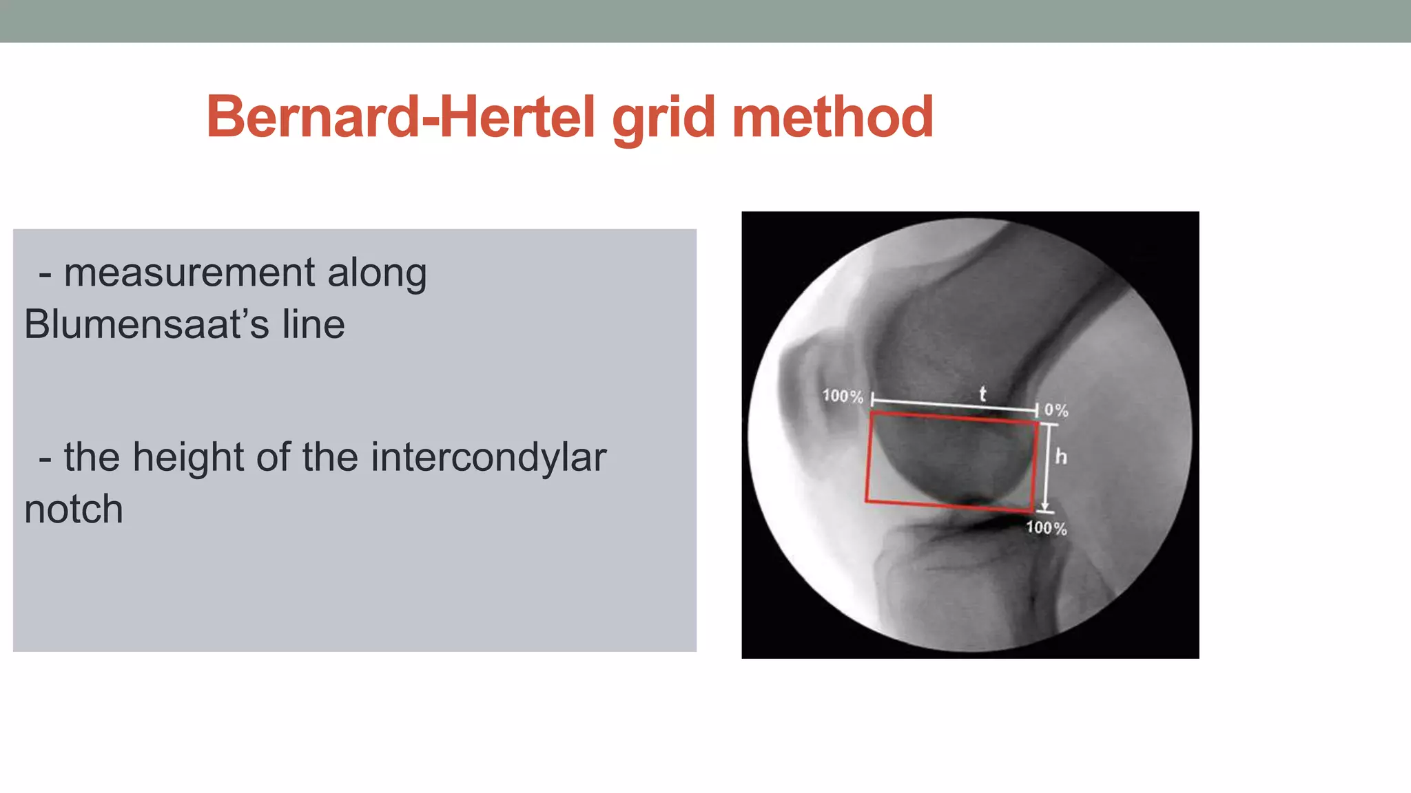 Acl reconstruction | PPTX