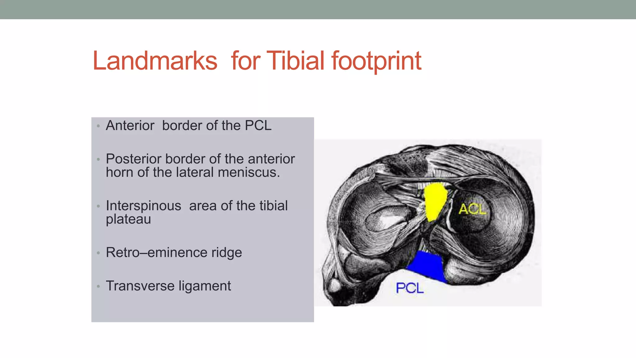 Acl reconstruction | PPTX