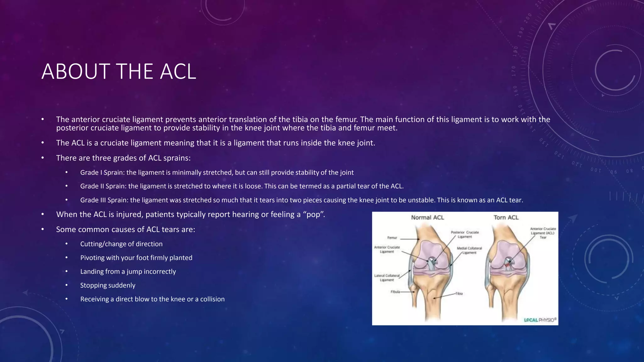 Acl reconstruction case study | PPTX