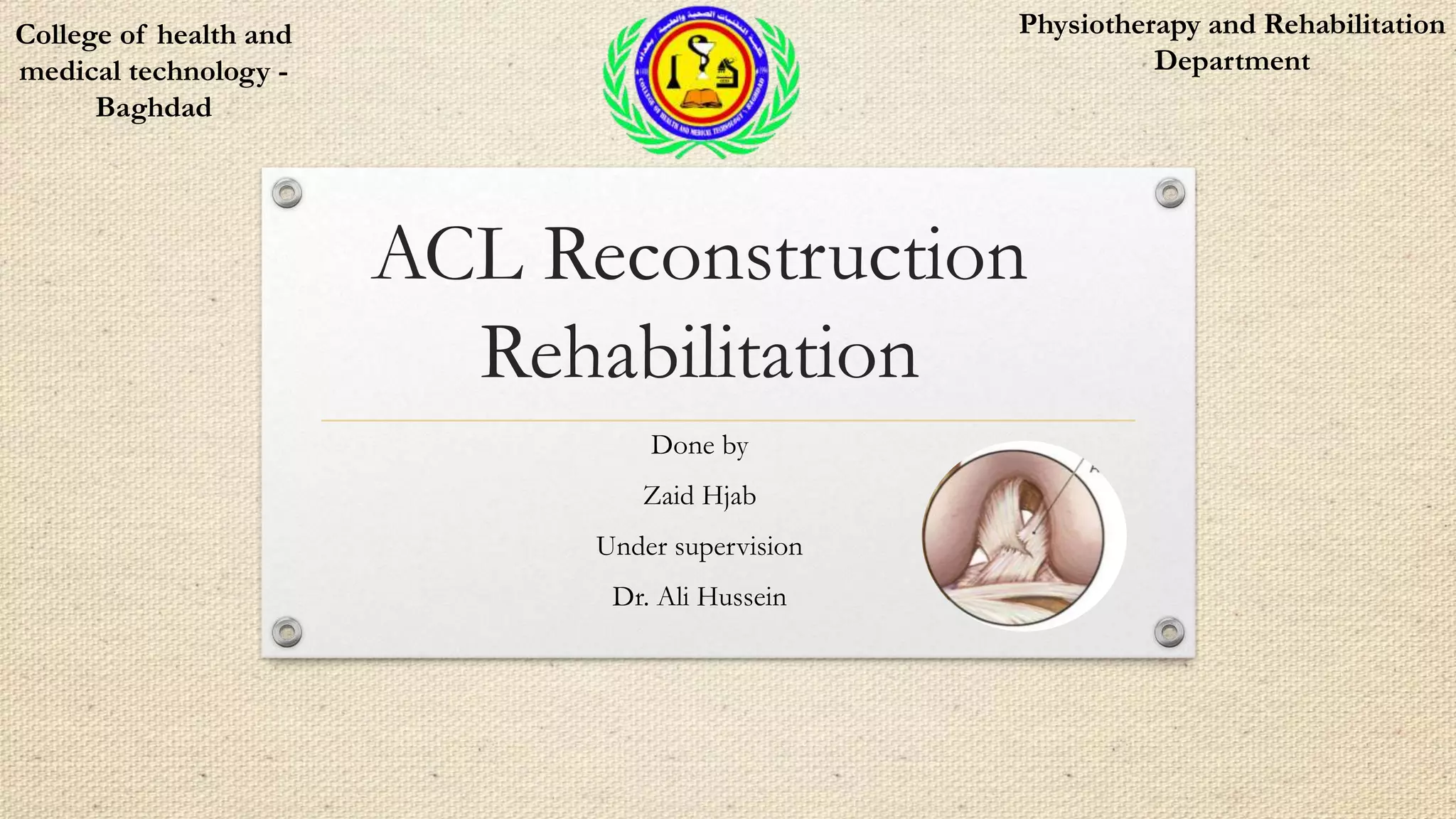 Acl reconstruction rehablition (zaid hjab) | PPTX