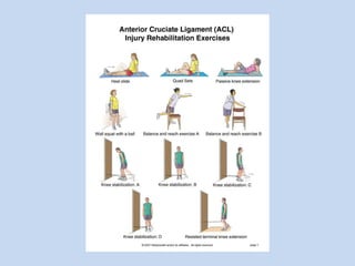 Acl rehab3 | PPTX