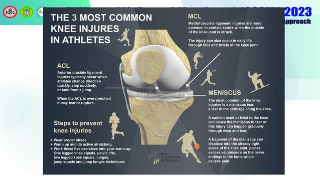 Acl rehabilitation....................... | PPTX