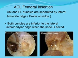 ACL injury surgery treatment options I Dr.RAJAT JANGIR orthopaedic ...