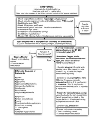 Acls Pacing Algorithm