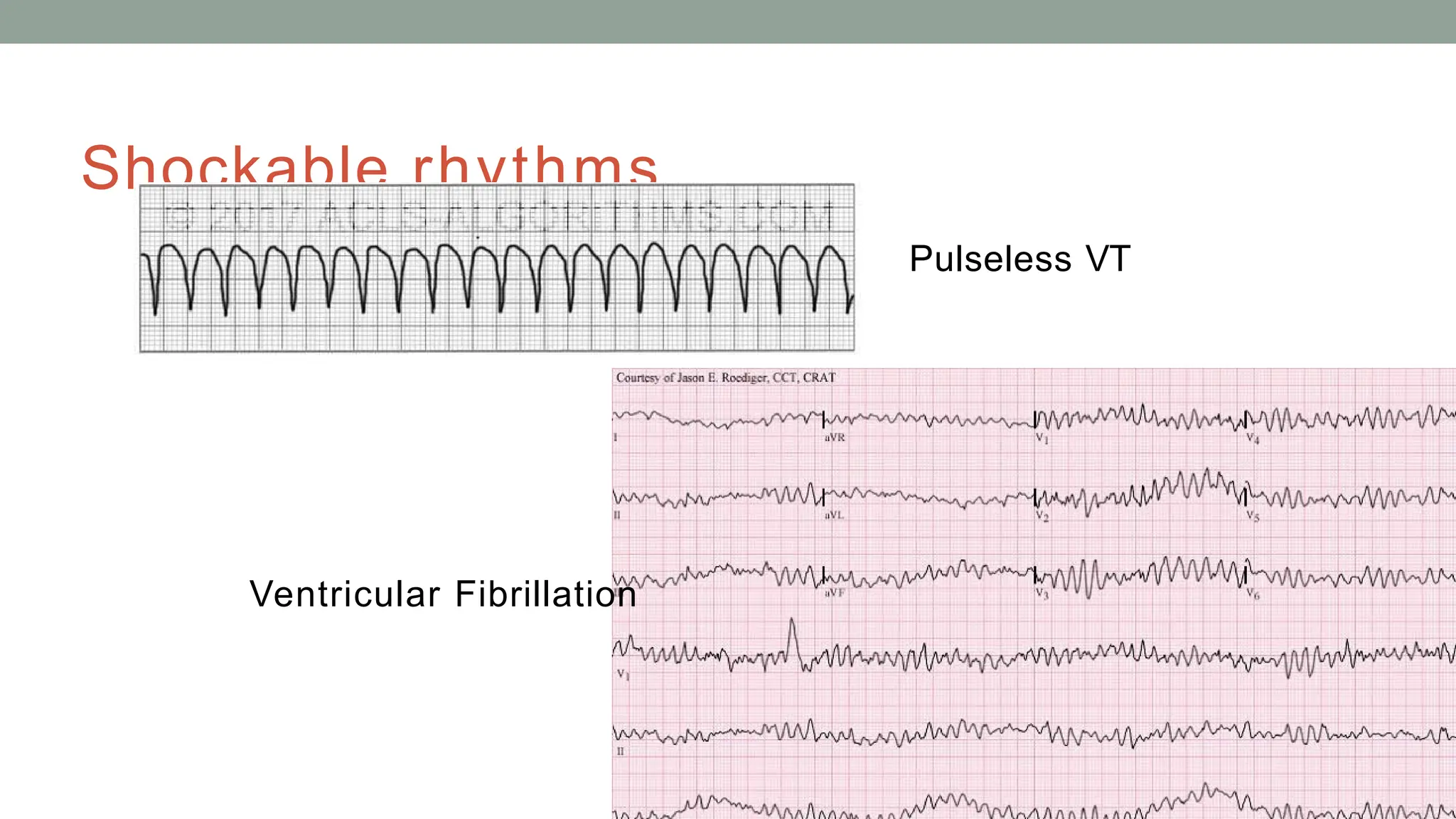 advance cardiac life support skills.pptx