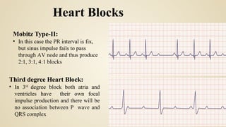 ACLS design to response effectively in cardiac emergency | PPTX