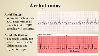 ACLS design to response effectively in cardiac emergency | PPTX