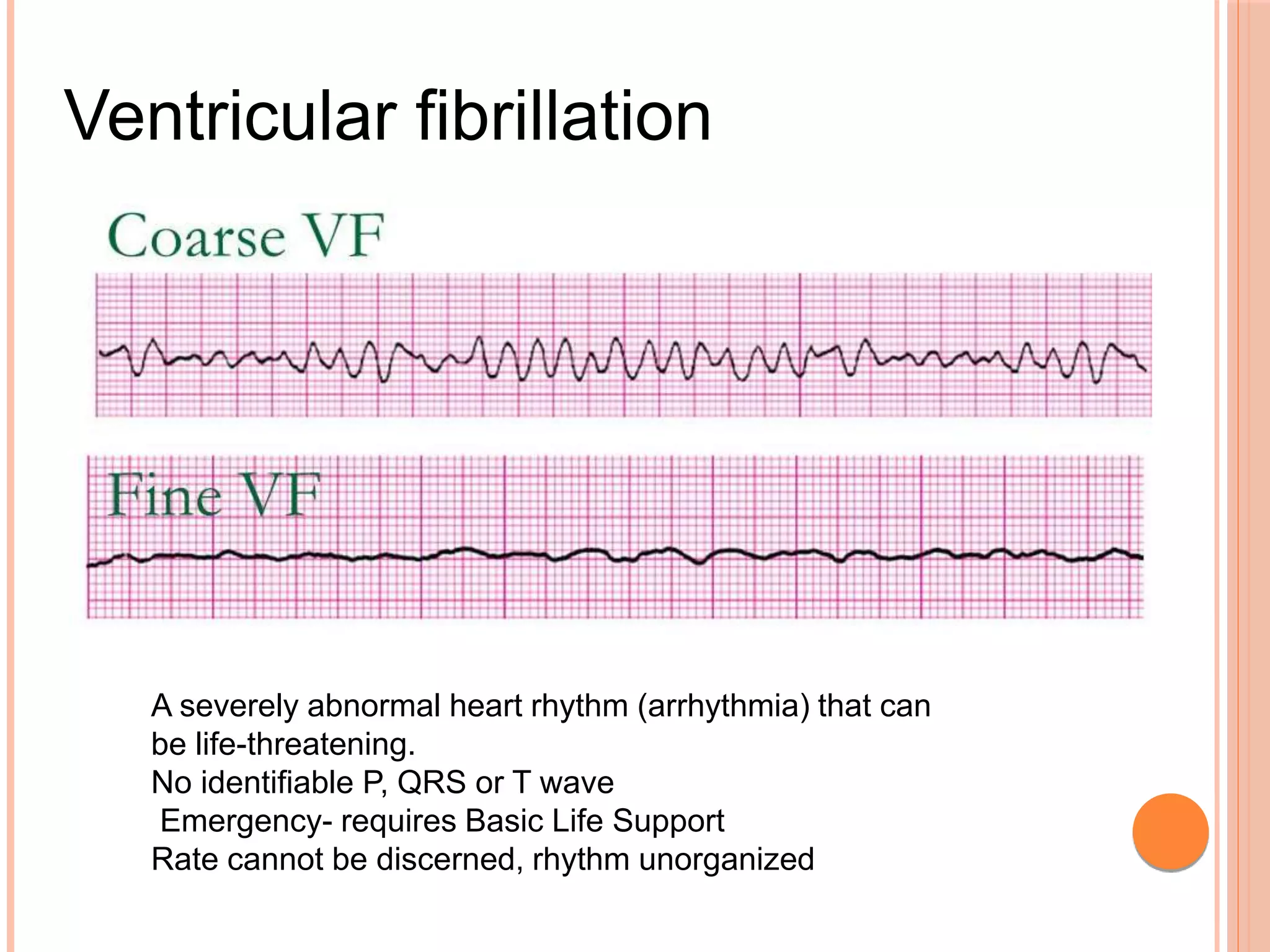 Acls advanced cardiac life support | PPTX | First Aid | Injuries