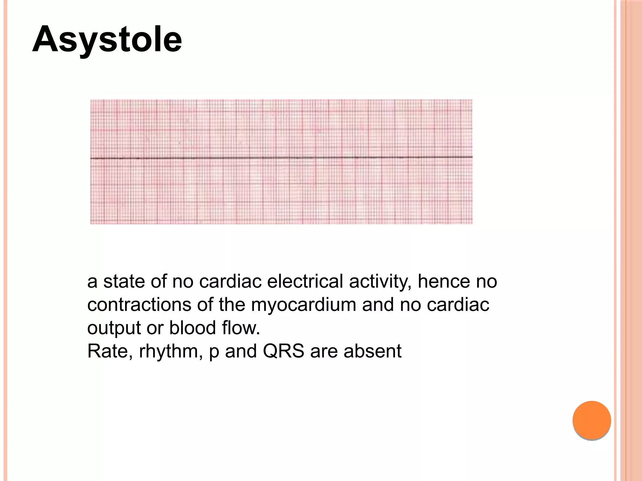 Acls advanced cardiac life support | PPTX
