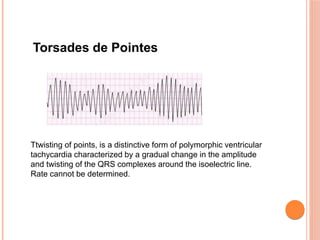 Acls advanced cardiac life support | PPT
